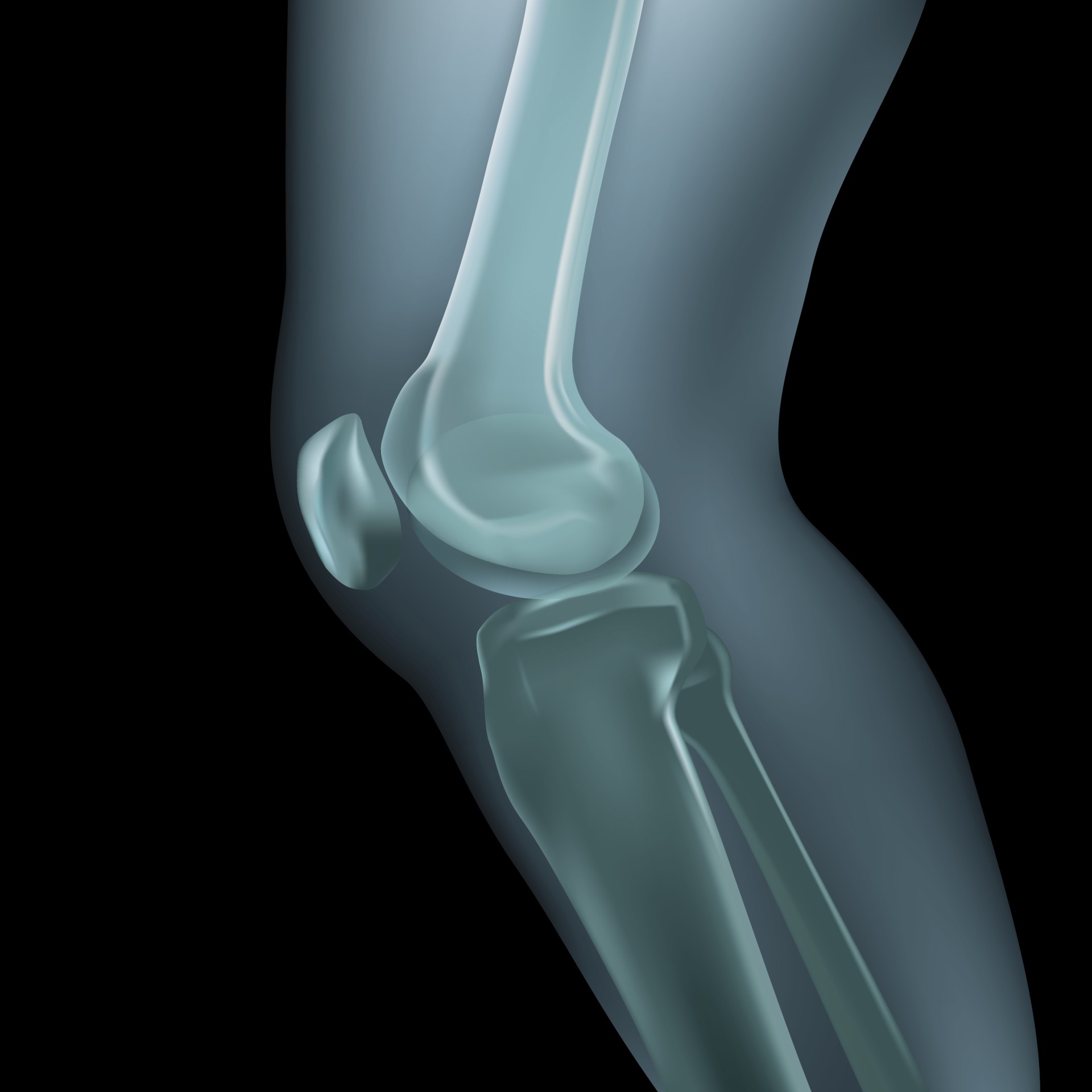 Advanced 3D-Printed Models for Knee OA Treatment - Oasis Training Platform